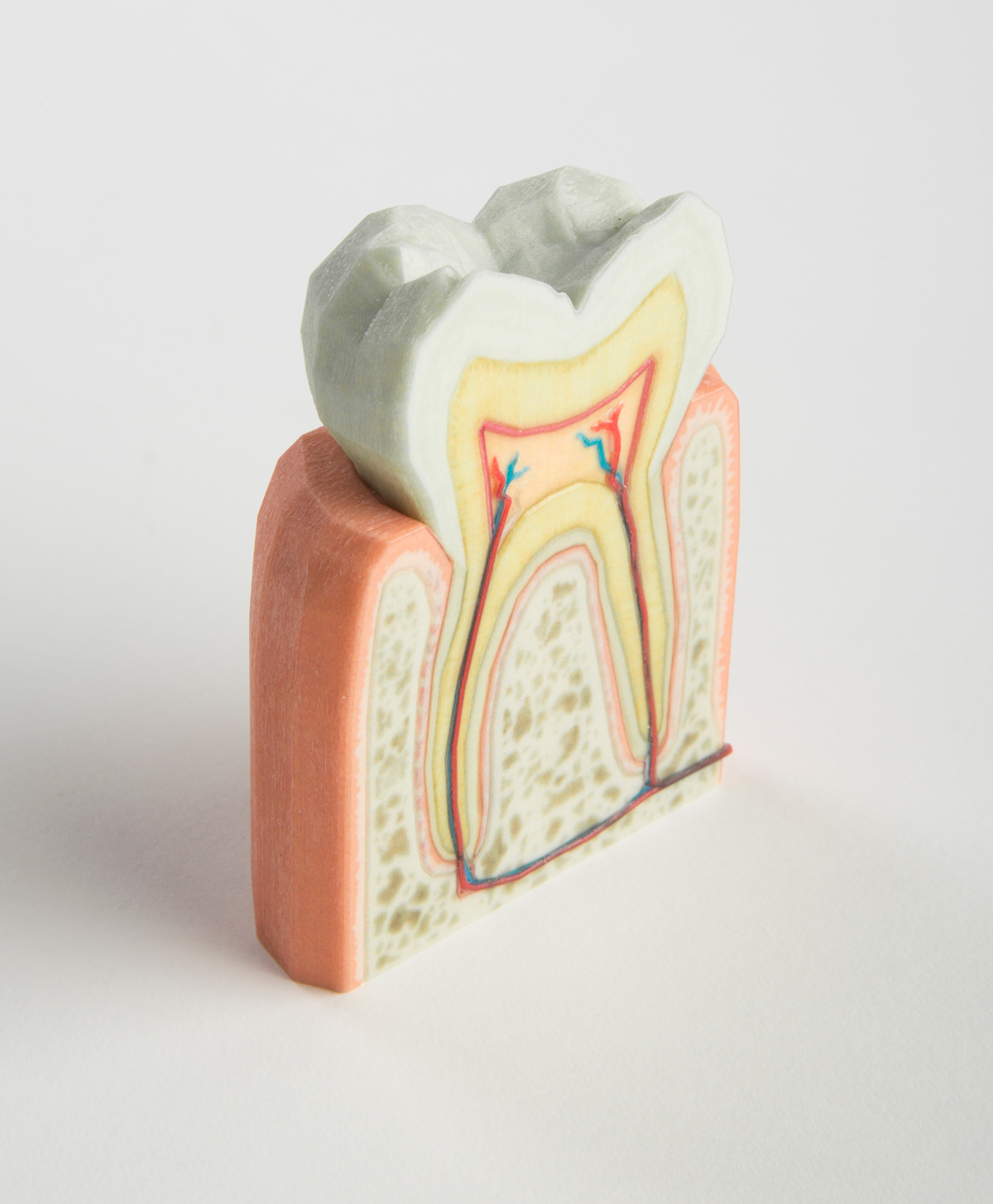 3D_printing_tooth-model_DENTAL_canada-mimaki – Objex Unlimited